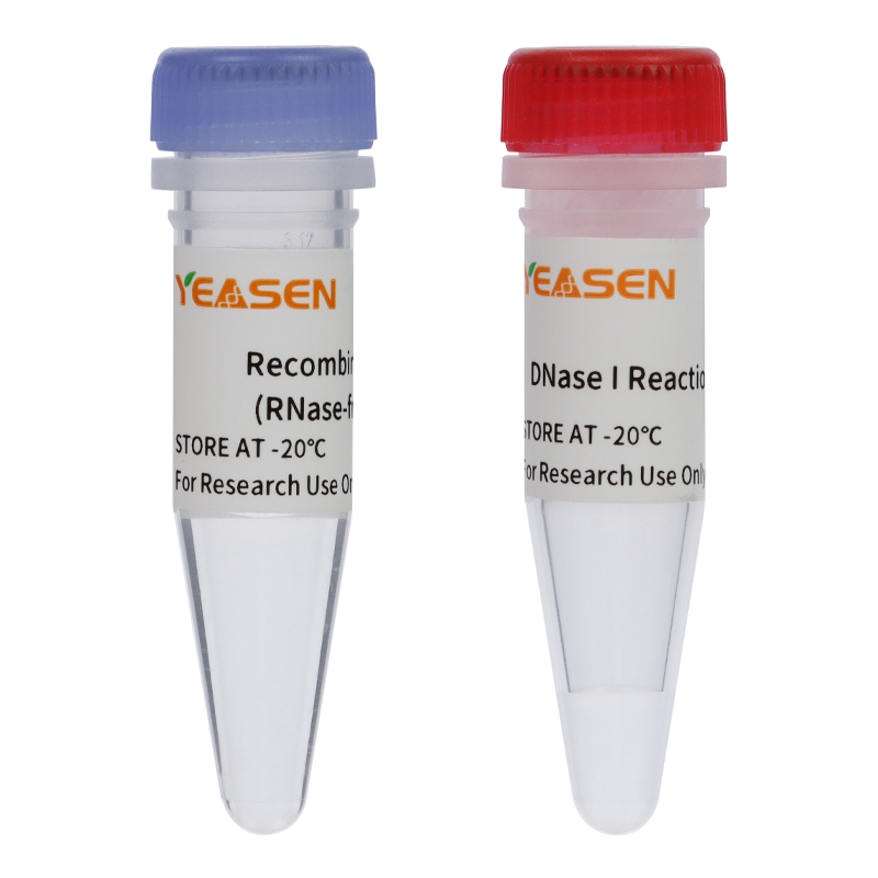 YEASEN Recombinant Deoxyribonuclease I (DNase I, RNase-free) (2 U/uL ...